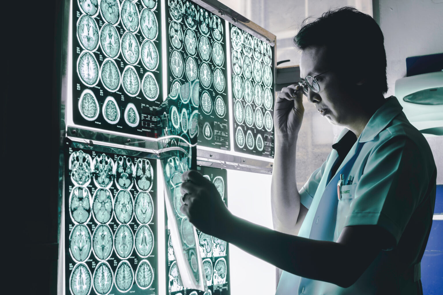 Understanding the Impact of Norepinephrine Deficiency on Brain Health ...