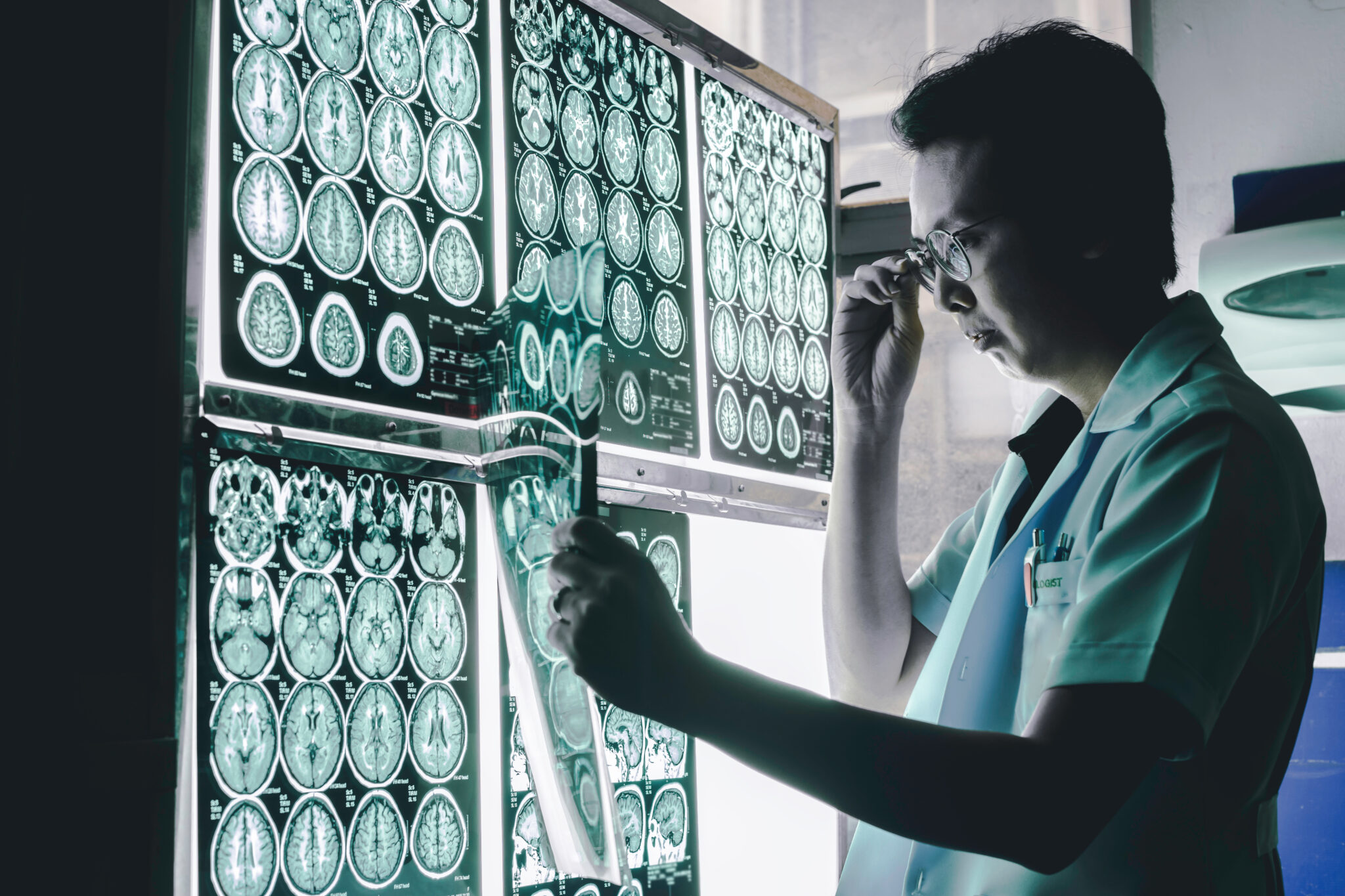 Understanding the Impact of Norepinephrine Deficiency on Brain Health ...