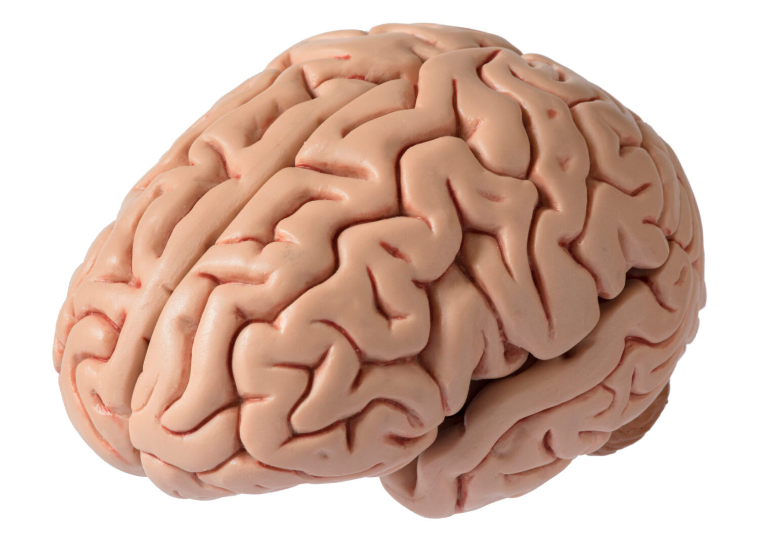 Parietal lobe dysfunction in Alzheimer’s – HelpDementia.com