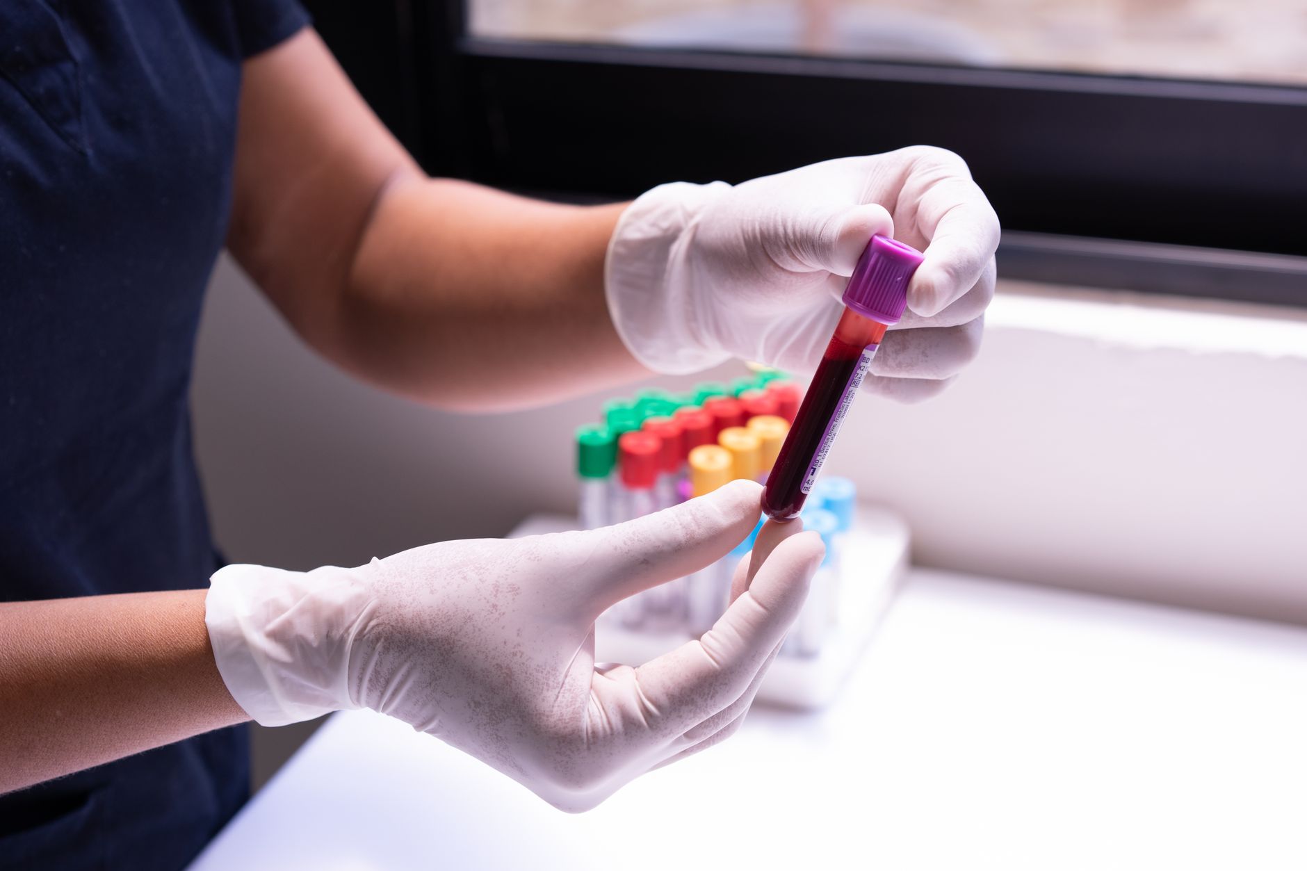 Could Blood Tests Reduce the Need for Repeated Brain Scans ...